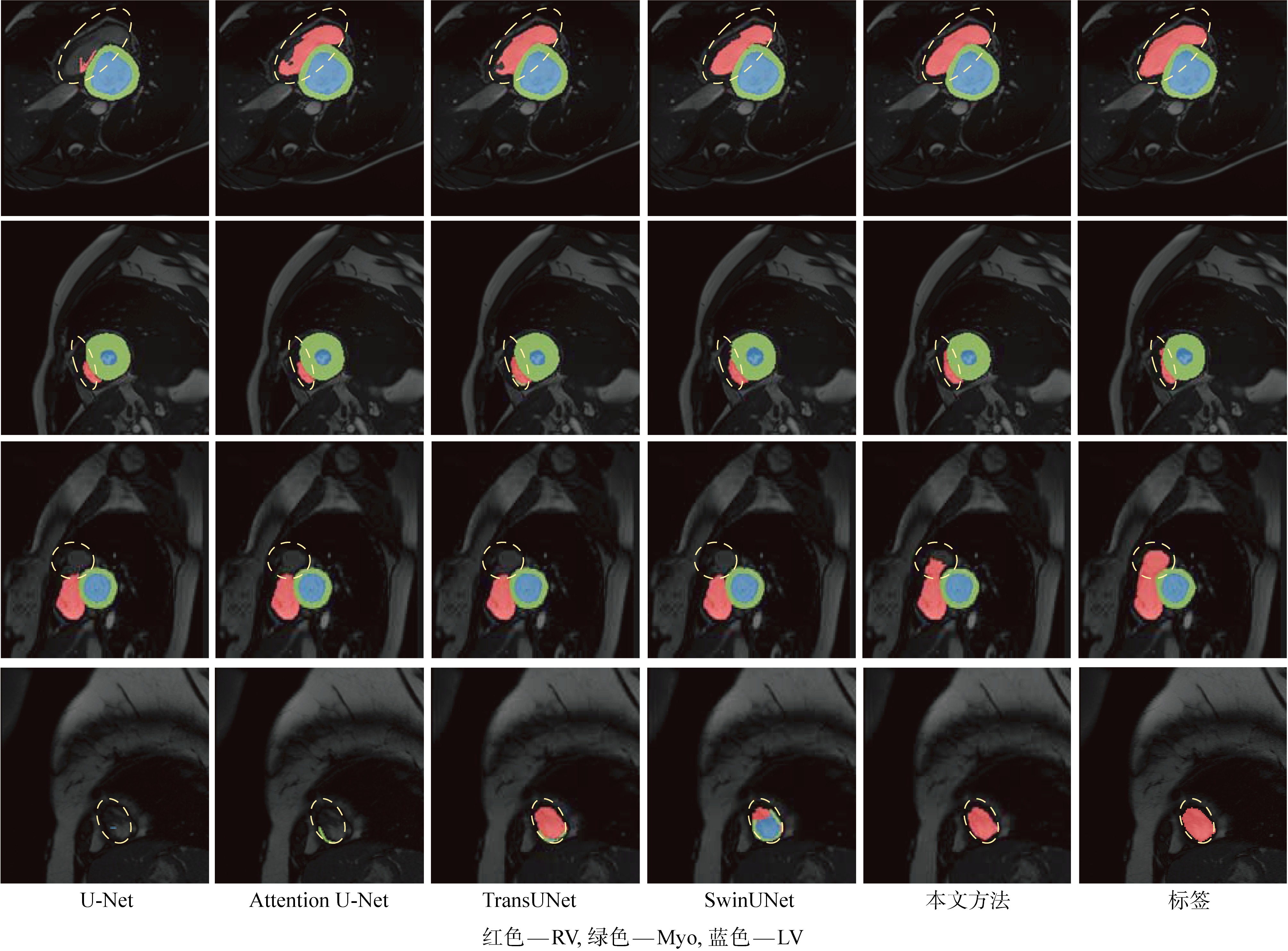 UConvTrans:全局和局部信息交互的双分支心脏图像分割